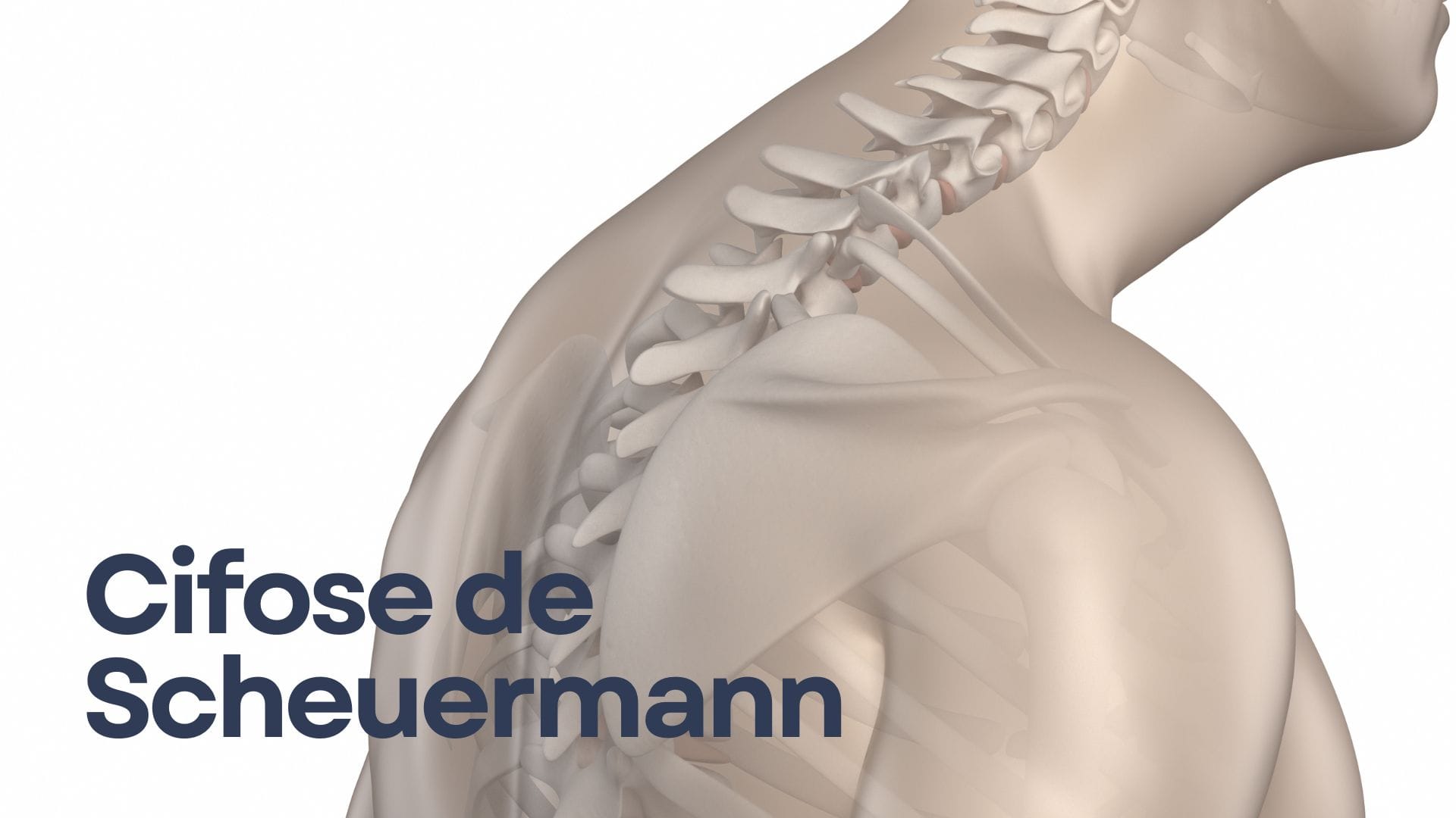 Dr. Juliano Rodrigues - Médico Especialista em Coluna Vertebral